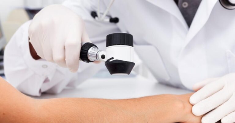 Sensation de brûlure au bras - Symptômes, causes, traitements