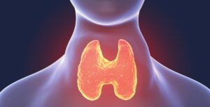 Symptômes, facteurs de risque et traitement du goitre